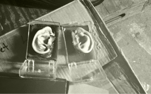 Blue Velvet Ear Had Twin, David Lynch's Hair